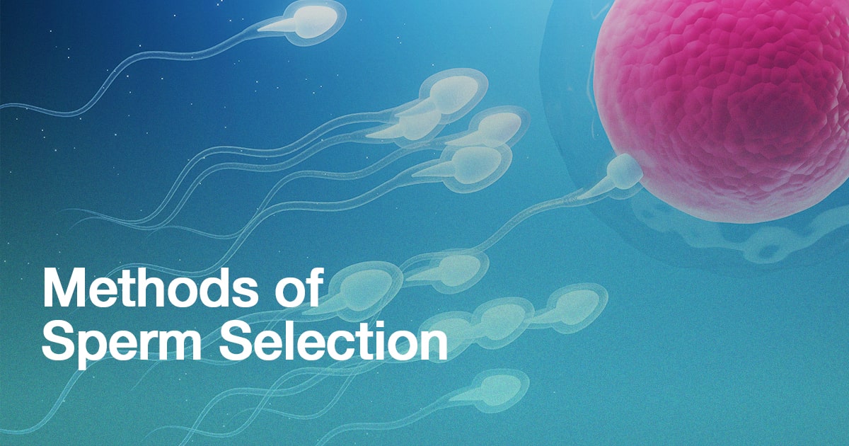 Methods of sperm selection | Esco Medical
